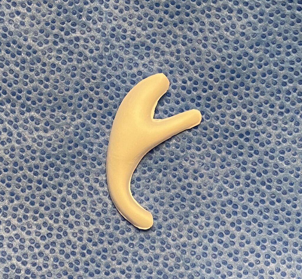 ePTFE-Coated Implant System for Ear Reconstruction - Explore Plastic Surgery