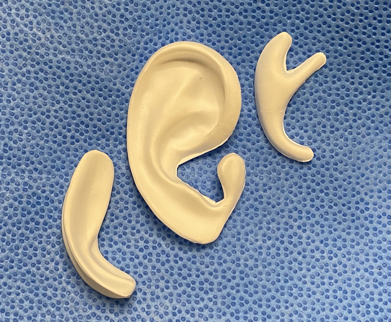 ePTFE-Coated Implant System for Ear Reconstruction - Explore Plastic ...