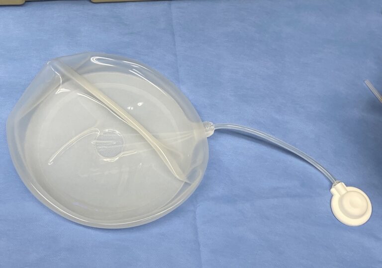 1st Stage Scalp Expander Placement for Large Custom Skull Implants ...