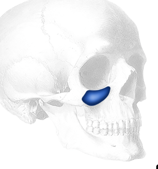 Technical Strategies - Treating the Cheek Implant Stepoff Deformity ...