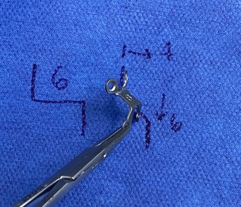 Plastic Surgery Case Study - The Angular Geometry of Plate Fixation in ...