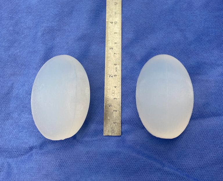 6.6cm custom testicle implants intraop Dr Barry Eppley - Explore ...