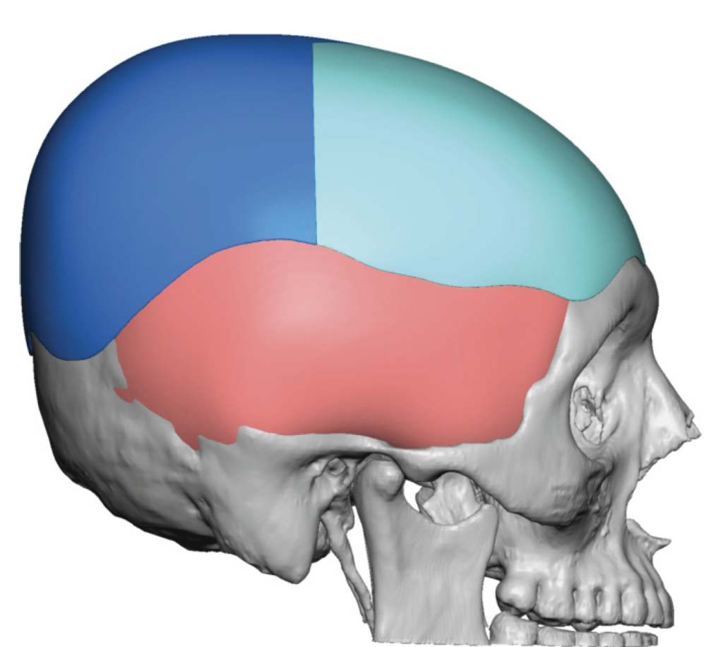 Plastic Surgery Case Study - The Male Extended Custom Forehead-Skull ...