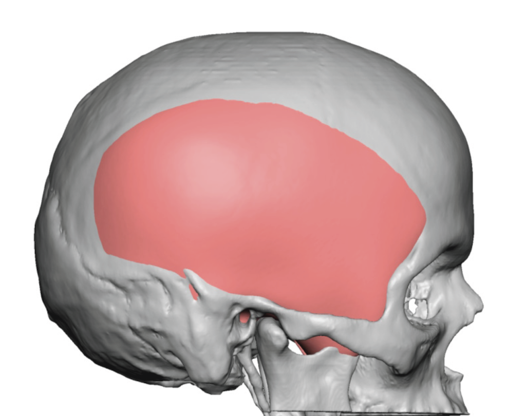 Plastic Surgery Case Study - Correction of the Forward Sloping Skull ...