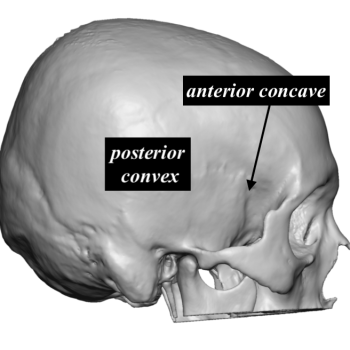 temporal reduction Archives - Explore Plastic Surgery