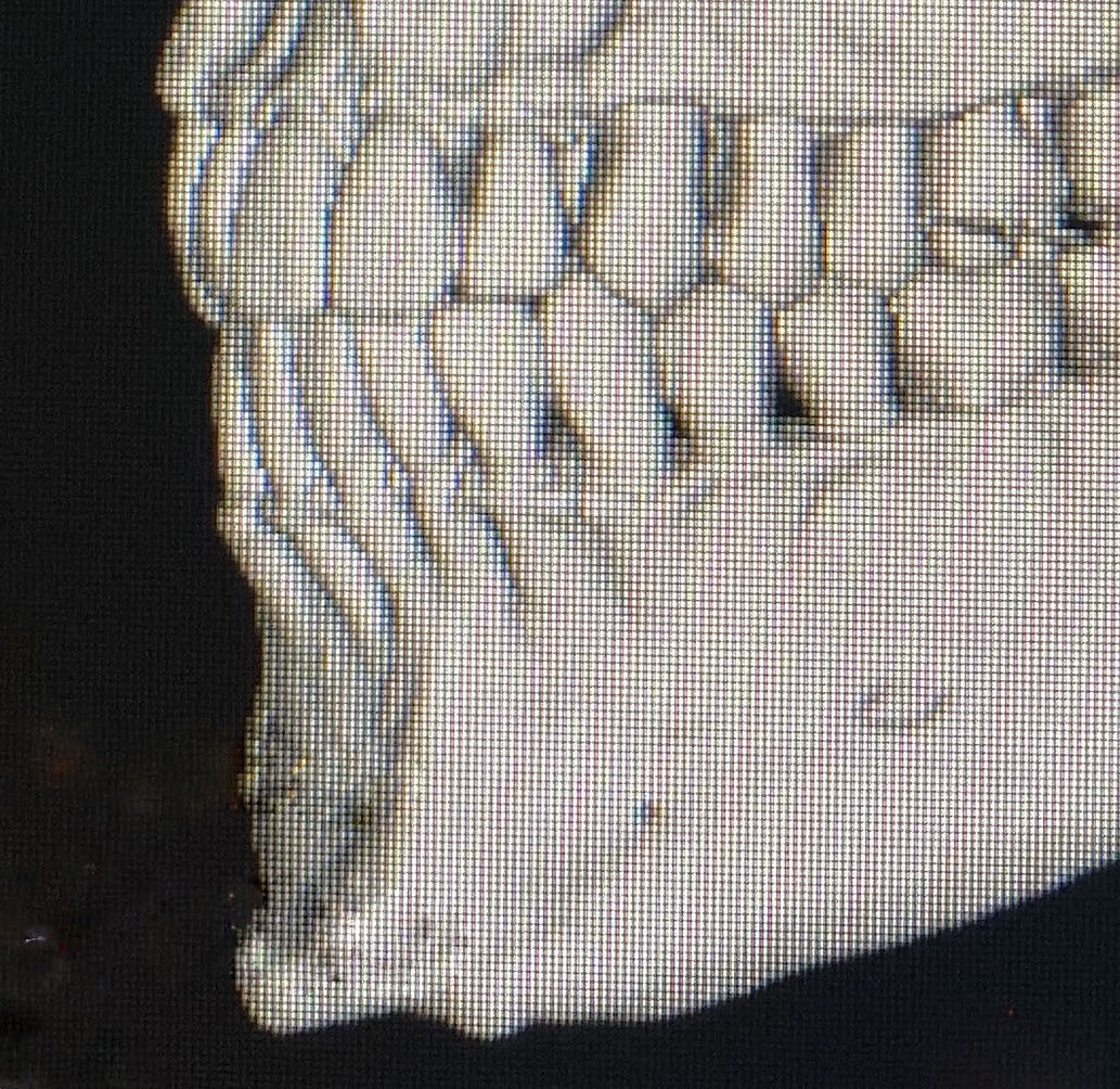 male square chin oblique view 3D CT scsan Dr Barry Eppley - Explore ...