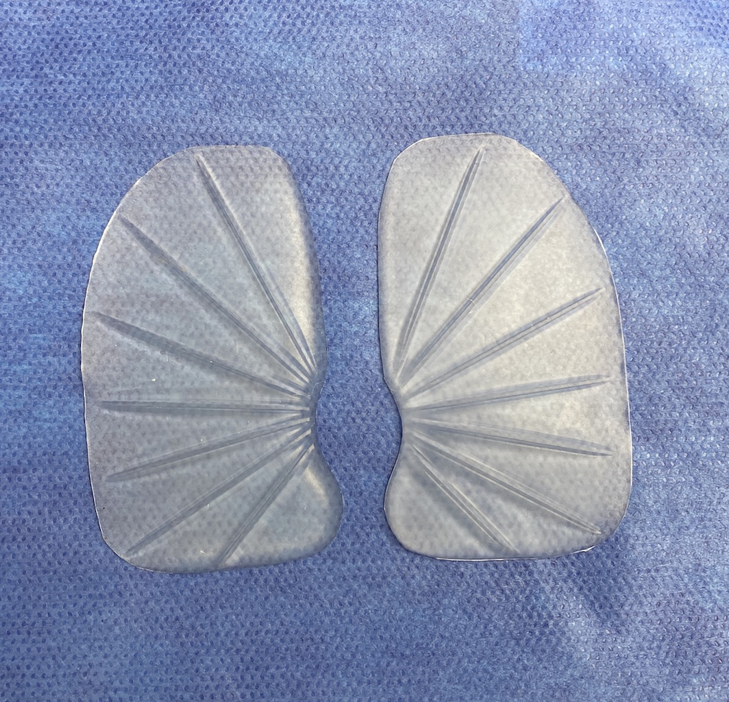 Plastic Surgery Case Study - Temporal Implants Placement through ...