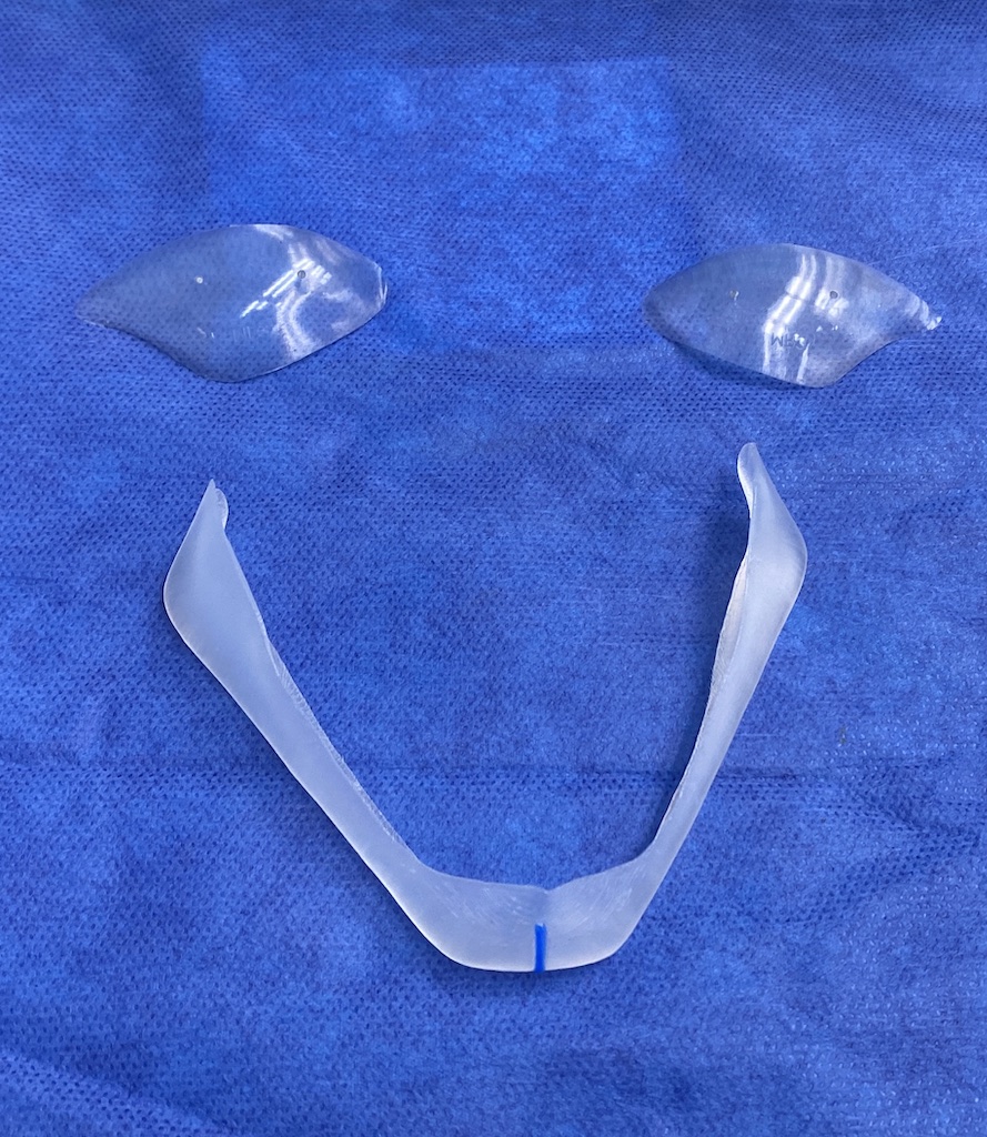 female custom jawline and standard cheek implants intraop Dr Barry ...