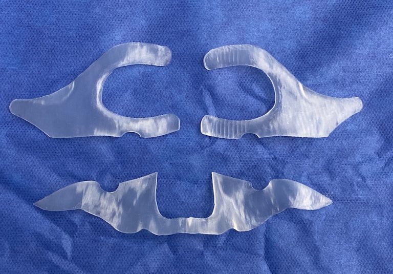 three piece custom total midface mask implant inmtraop Dr Barry Eppley ...