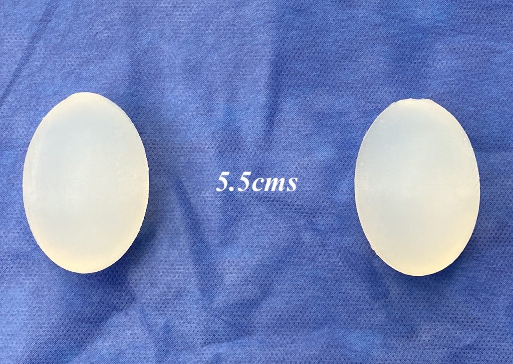 Plastic Surgery Case Study - Correcting Penile-Scrotal Disproportion ...