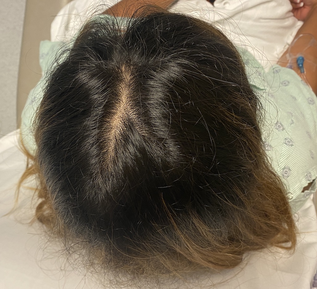 Technical Strategies - Hair Management in Female Aesthetic Skull ...