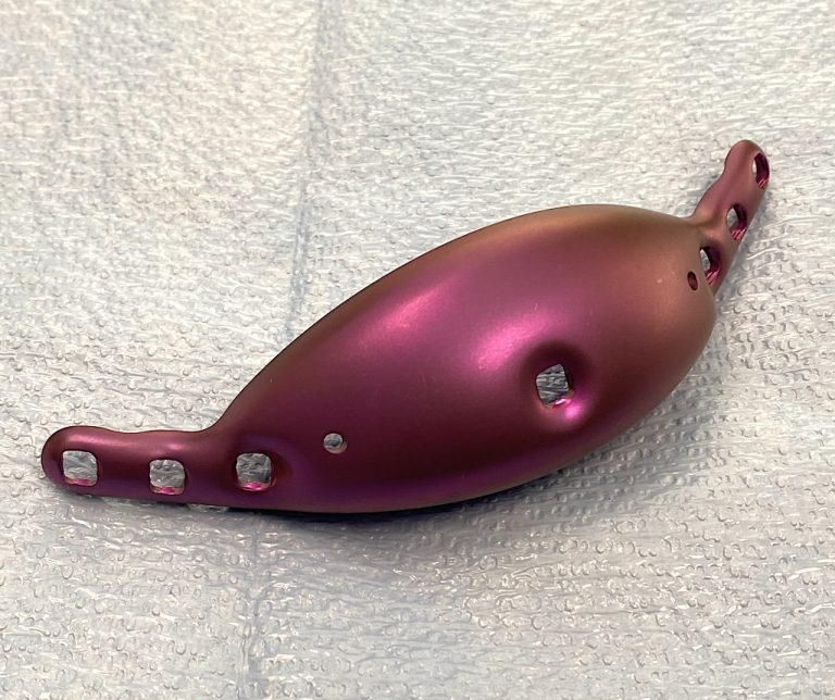 Pelvis Plasty for Upper Hip Widening - Iliac Crest Plate Design ...