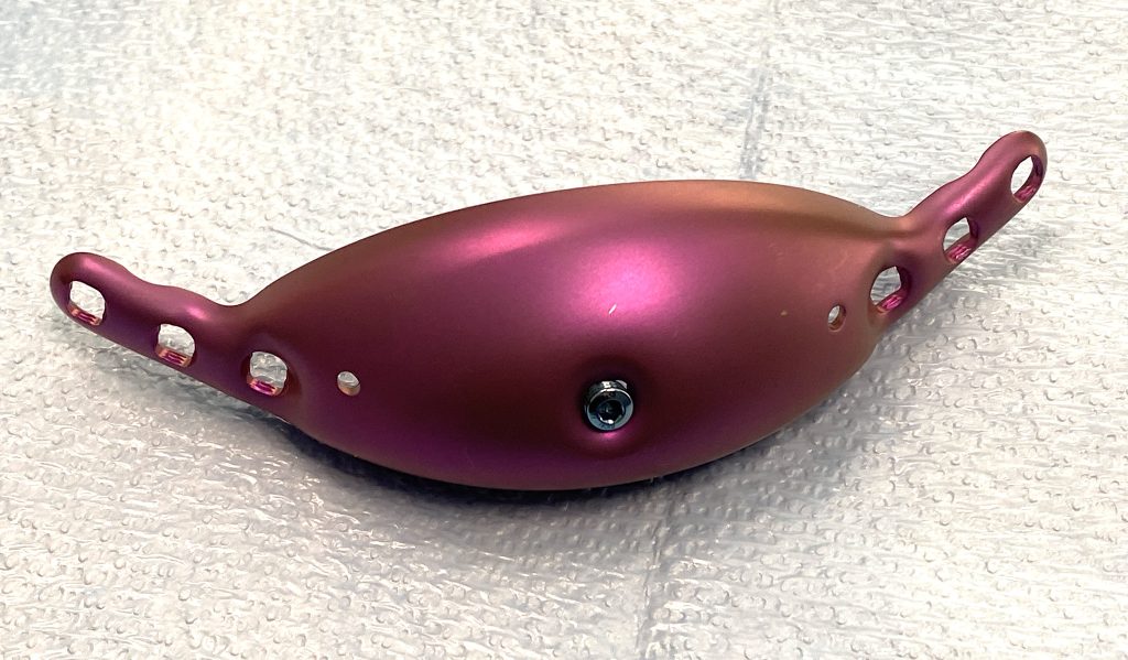 Pelvis Plasty for Upper Hip Widening - Iliac Crest Plate Design ...