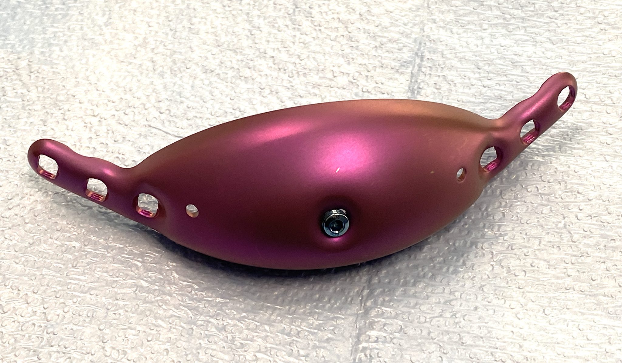 Pelvis Plasty for Upper Hip Widening - Iliac Crest Plate Design ...