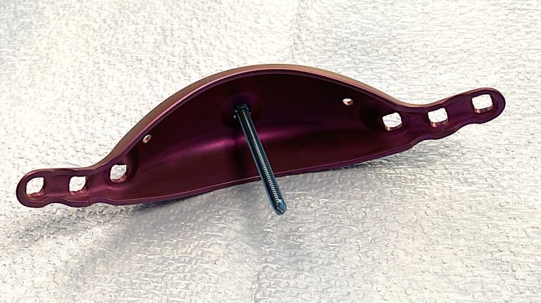 Pelvis Plasty for Upper Hip Widening - Iliac Crest Plate Design ...