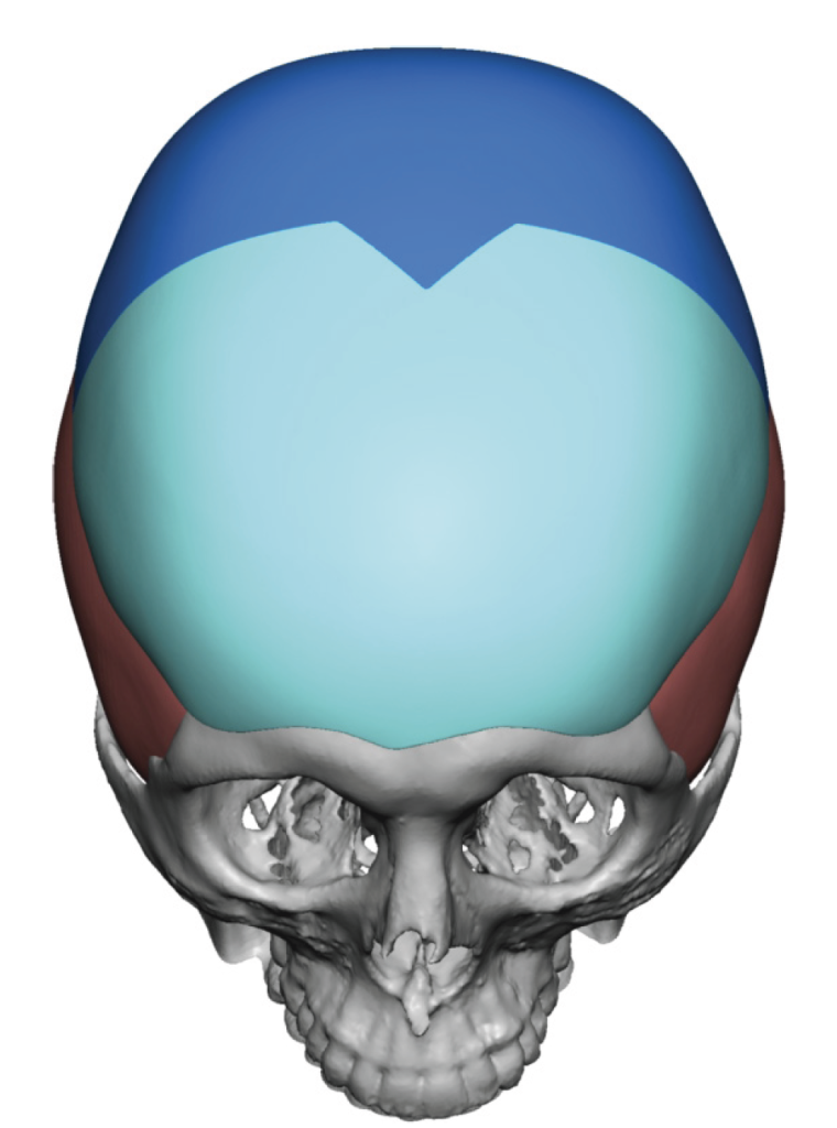 Interactions Between Custom Facial Implants and Aesthetic Injections ...