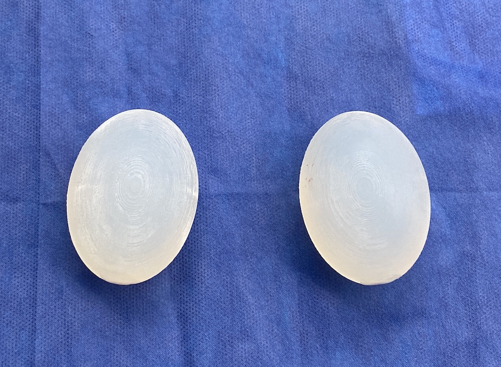 Custom 6 7cm Testicle Implants Intraop Dr Barry Eppley Explore