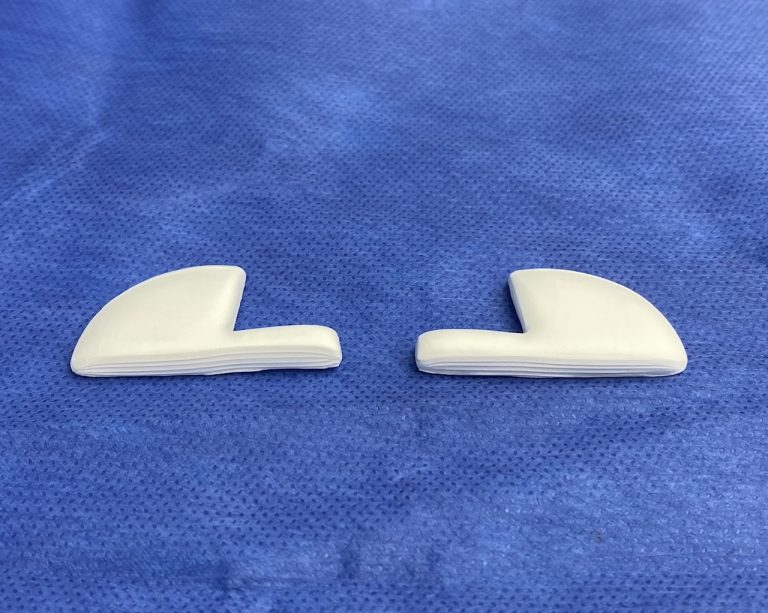 ePTFE paranasal implants Dr Barry Eppley - Explore Plastic Surgery