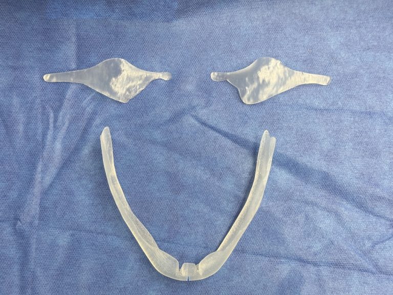 Plastic Surgery Case Study - Custom Cheek and Jawline Implants for V ...