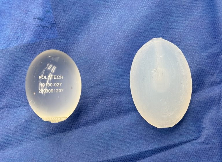 custom testicle implant replacement Dr Barry Eppley - Explore Plastic ...