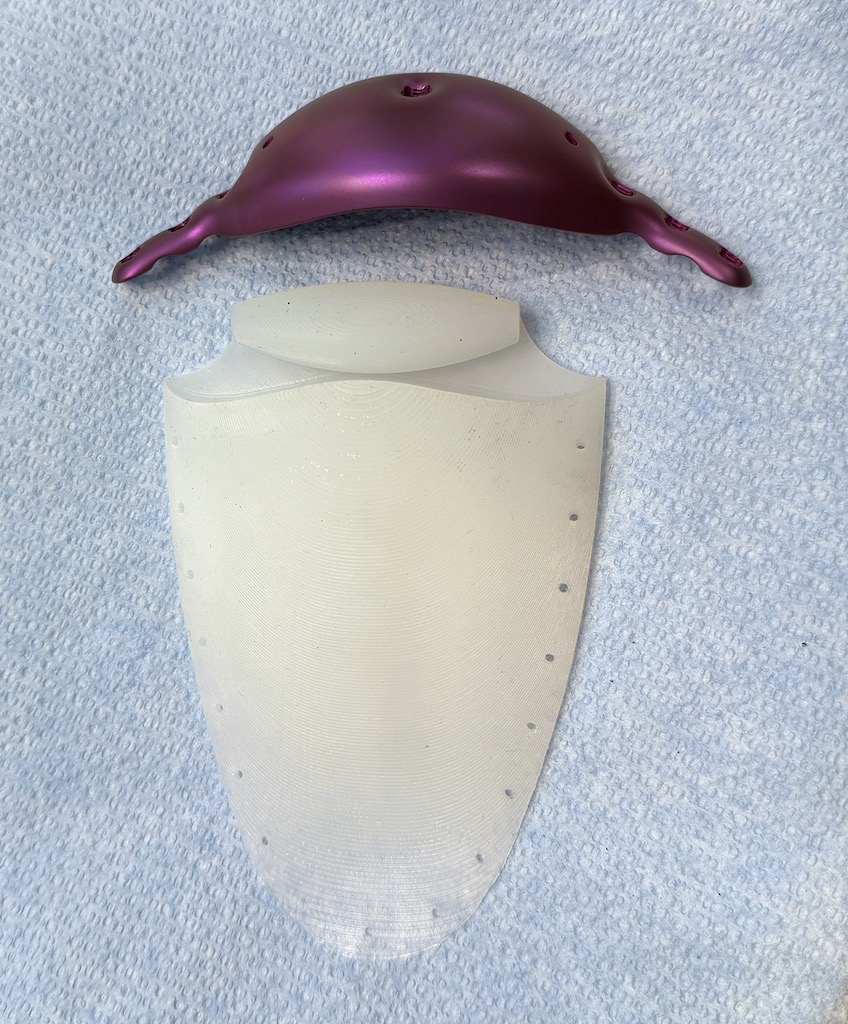 Pelvic Plasty - 4. The Sub Iliac Plate Hip Dip Implant - Explore ...