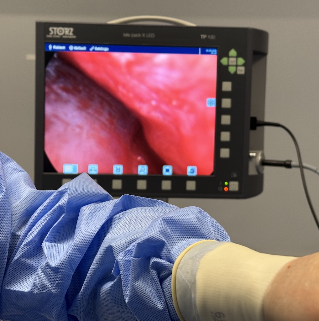 endoscopic-assisted custom forehead brow bone implant placement Dr ...