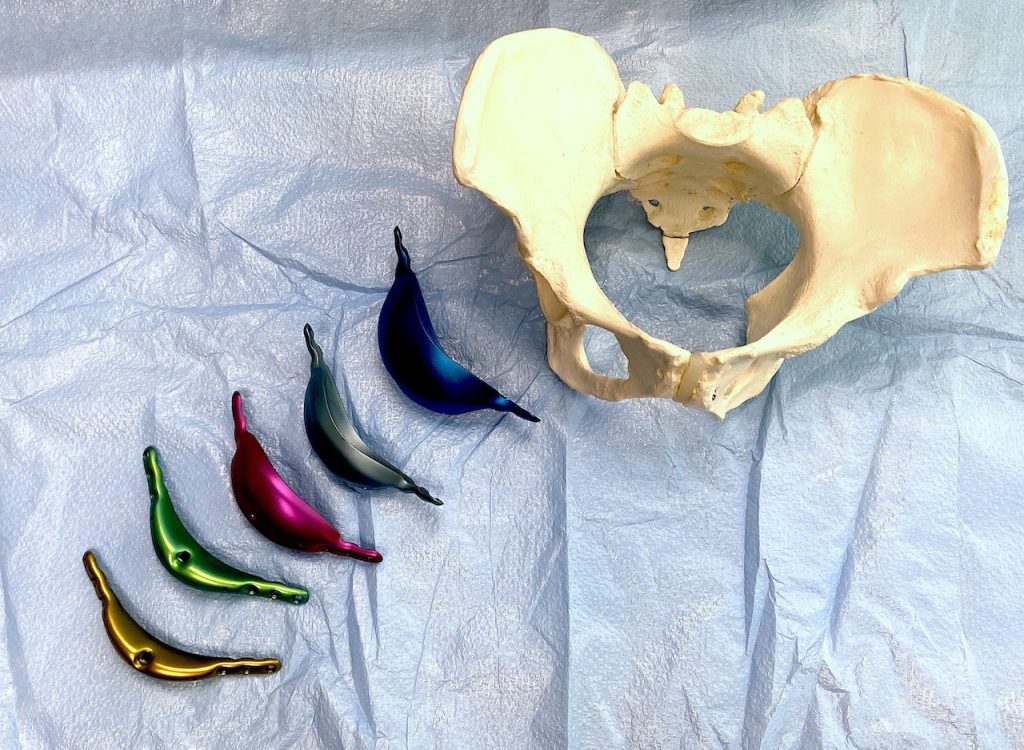 Pelvic Plasty - 2. The Iliac Plate - Explore Plastic Surgery