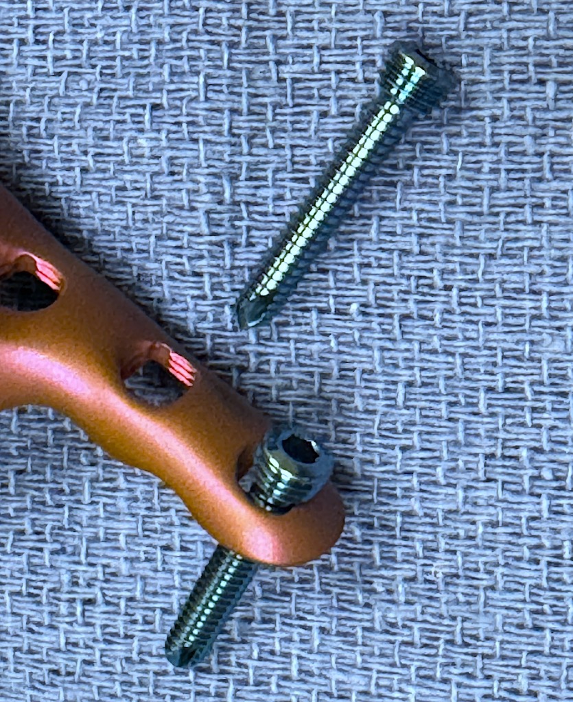 Pelvic Plasty - 2. The Iliac Plate - Explore Plastic Surgery