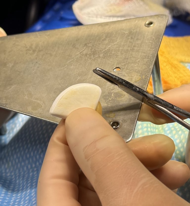 Technical Strategies - Intraoperative Shaping of ePTFE Paranasal ...