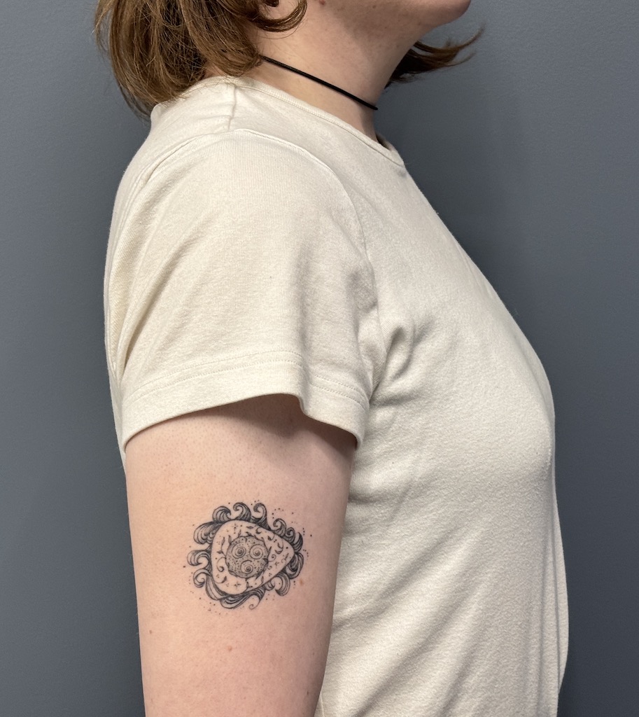 Plastic Surgery Case Study - Shoulder Shape Changes in Tall Female ...