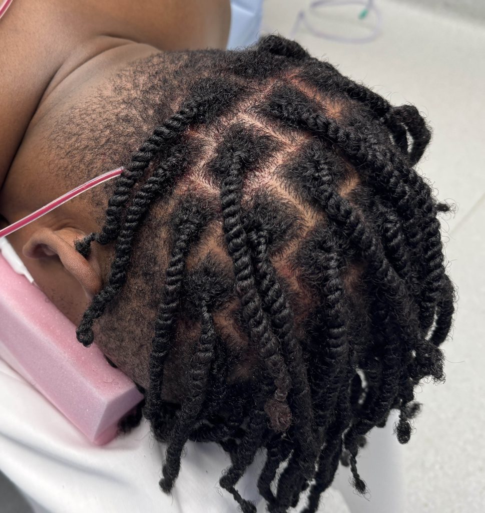 Plastic Surgery Case Study - Custom Skull Implant for Correction of ...