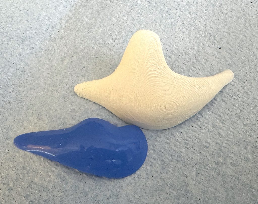 Plastic Surgery Case Study - Overlay Implant Augmentation After Custom ...