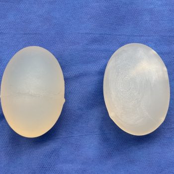 testicular implants Archives - Explore Plastic Surgery