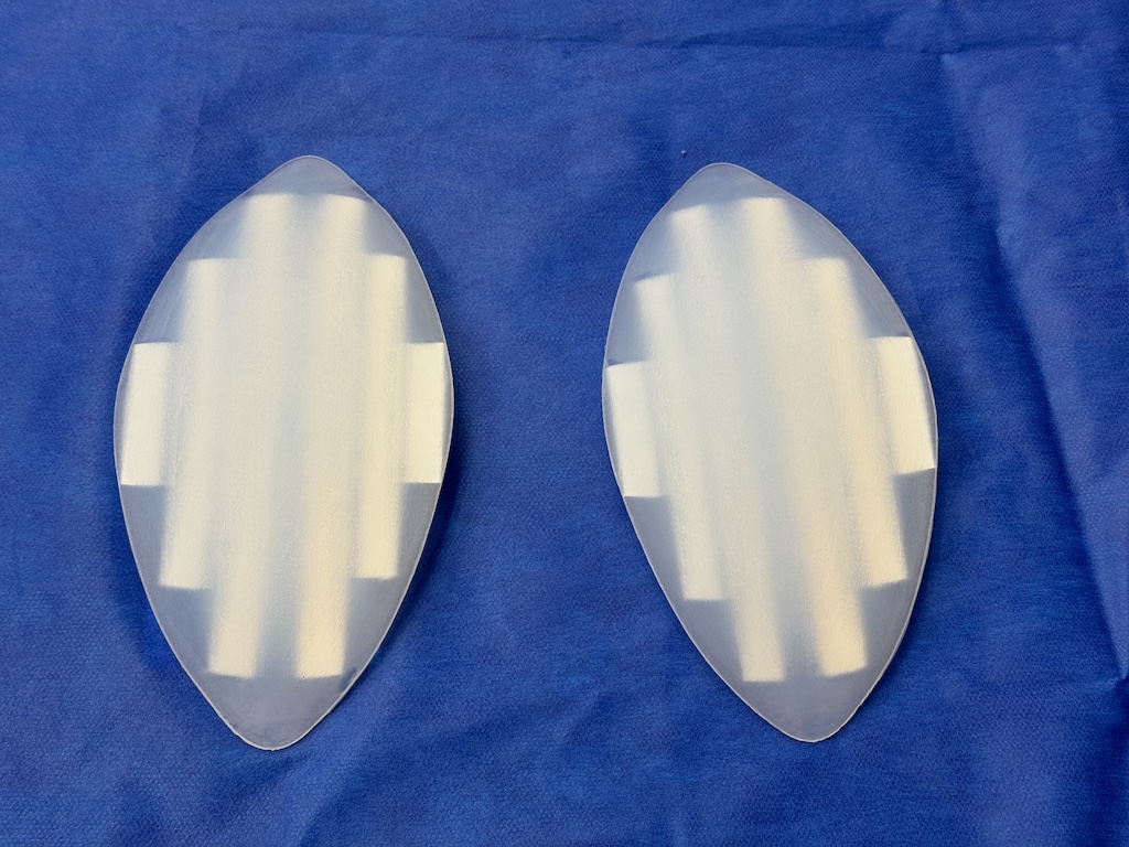 PLastic Surgery Case Study - Customn Buttock Implants for Lower Buttock ...