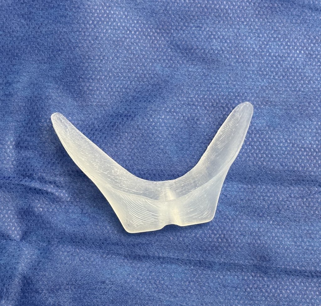 Plastic Surgery Case Study - Restoring Chin Masculinity with a Custom ...