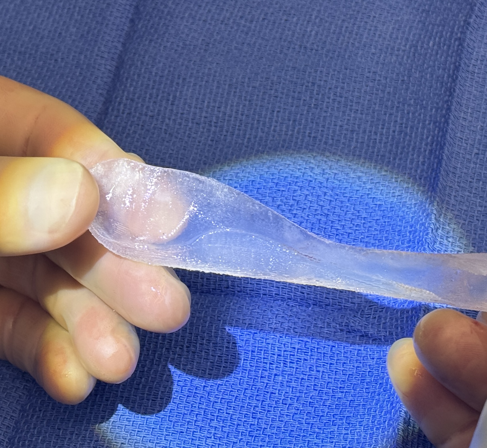 Key Considerations in Custom Jawline Implant Design: Focus on the Jaw ...