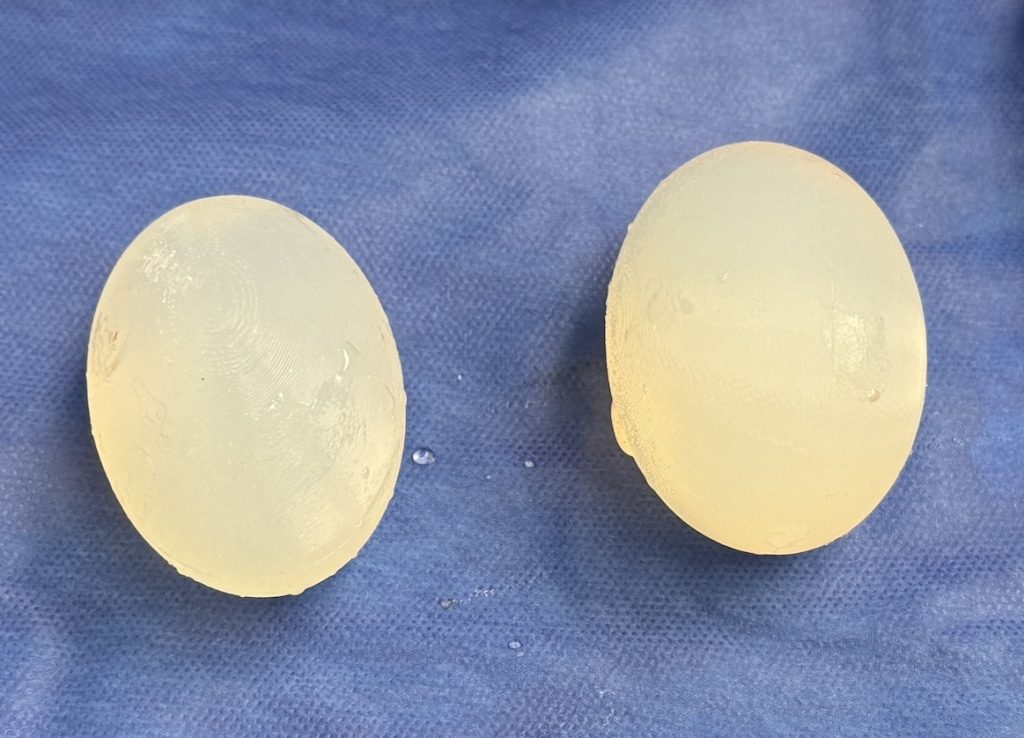 Custom Testicle Implants - An Overview - Explore Plastic Surgery