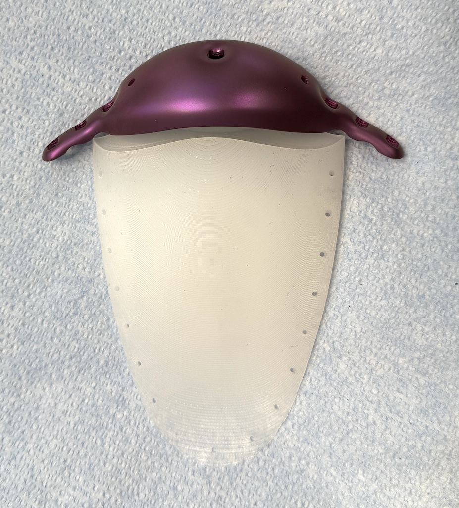 Pelvic Plasty for Female Body Contouring: Case Study and Long Term ...