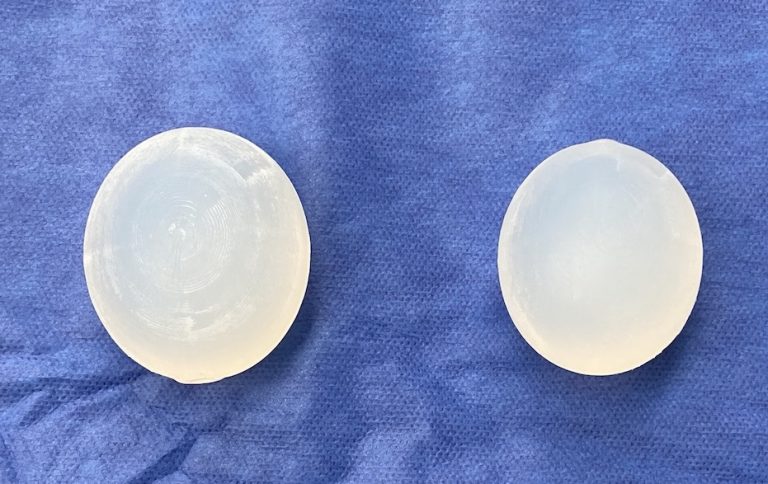 Testicle Implants and the Detection of Testicular Cancer - Explore ...