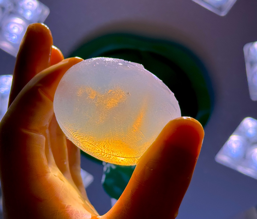 Custom Testicular Implants for Atrophied Testicles - Case Study ...