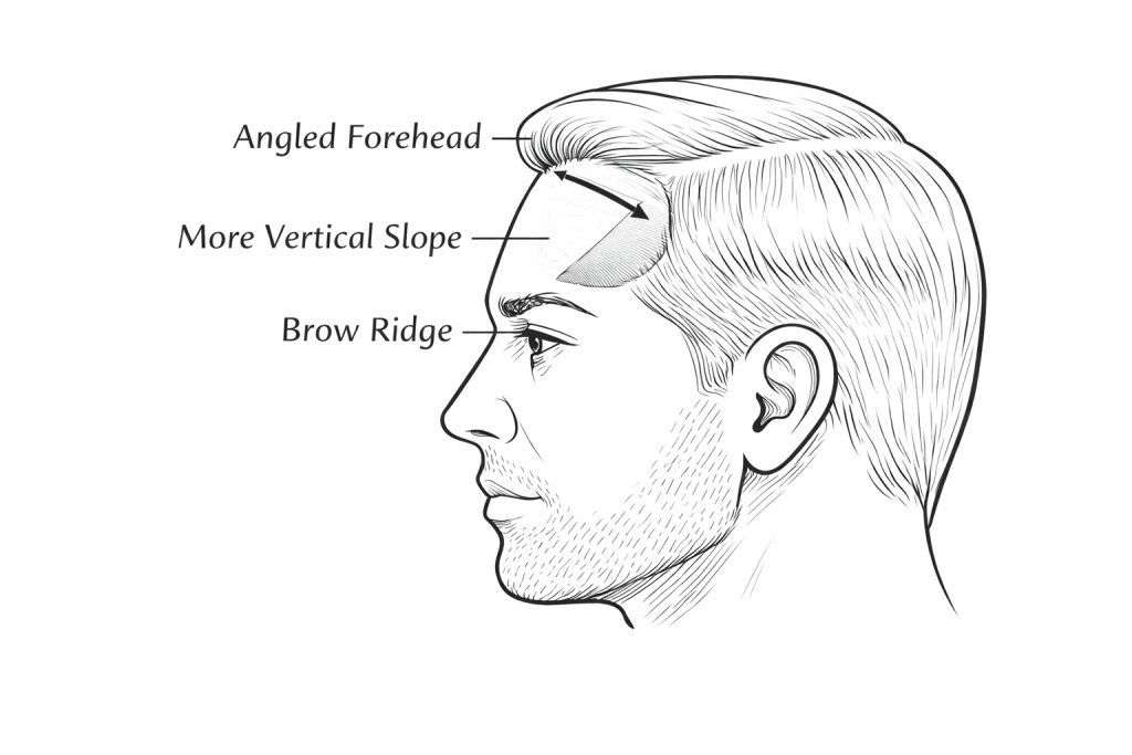 male forehead shaope characteristics side profile Dr Barry Eppley ...