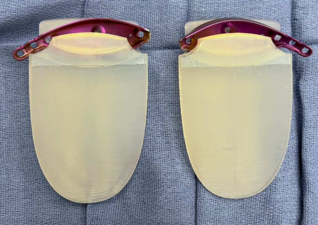 Iliac Crest Augmentation With Soft-Tissue Extended Flange Hip Implants ...