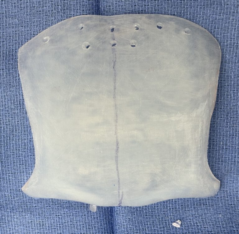 Custom Male Forehead-Brow Bone Implant Case Study - Explore Plastic Surgery